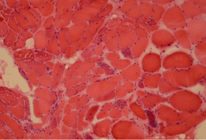 Muscle pathology, an overview – neuromyology